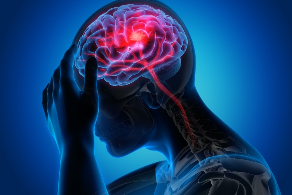 How Is the Severity of a Brain Injury Determined?